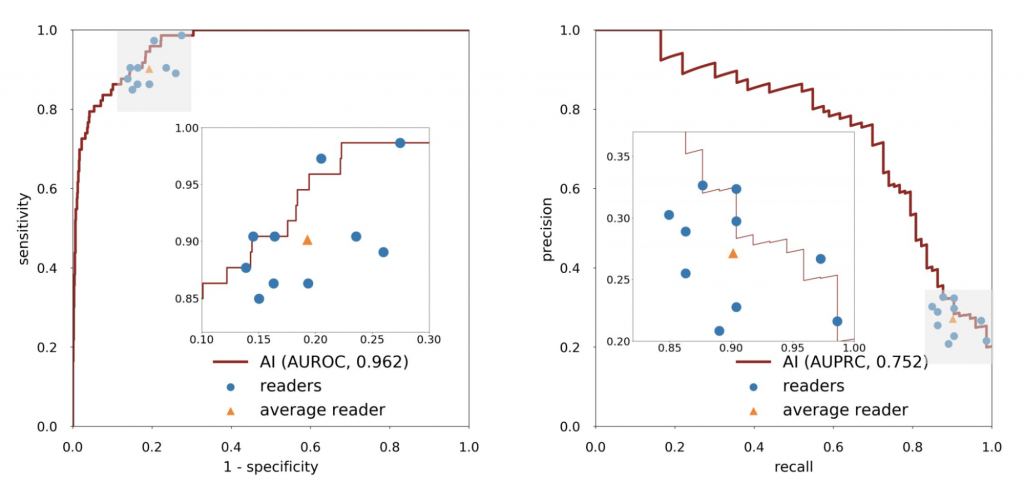 Improving Breast Cancer Detection in Ultrasound Imaging Using AI ... Improving Breast Cancer Detection in Ultrasound Imaging Using AI ...