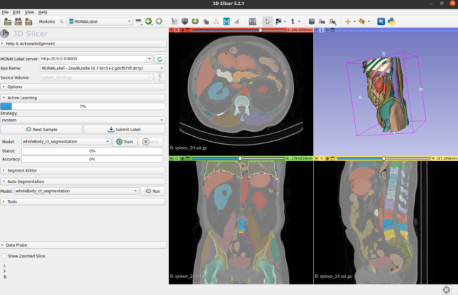 Visual Foundation Models for Medical Image Analysis | NVIDIA Technical Blog Visual Foundation Models for Medical Image Analysis | NVIDIA Technical Blog