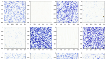 Improving Breast Cancer Detection in Ultrasound Imaging Using AI | NVIDIA Technical Blog