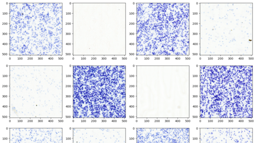 Improving Breast Cancer Detection in Ultrasound Imaging Using AI | NVIDIA Technical Blog