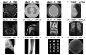 Advancing Medical Image Decoding with GPU-Accelerated nvImageCodec | NVIDIA Technical Blog