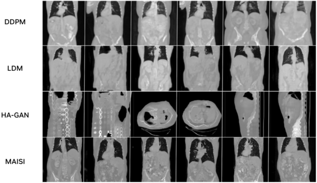 Addressing Medical Imaging Limitations with Synthetic Data Generation ...