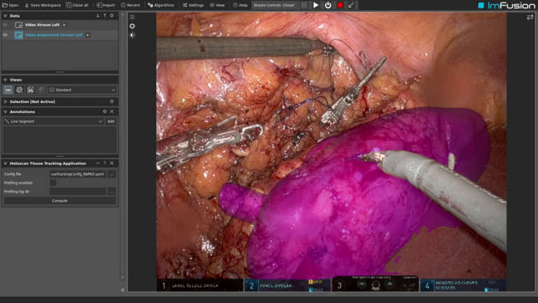 Real-Time Surgical Guidance by Fusing Multi-Modal Imaging with NVIDIA ...