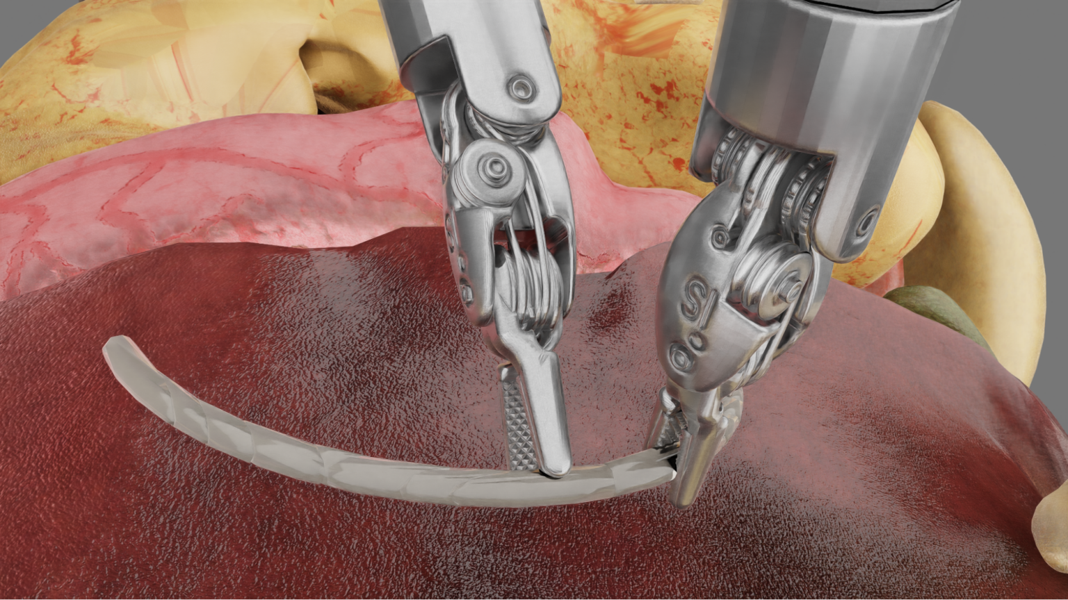 Advancing Surgical Robotics with AI-Driven Simulation and Digital Twin ...